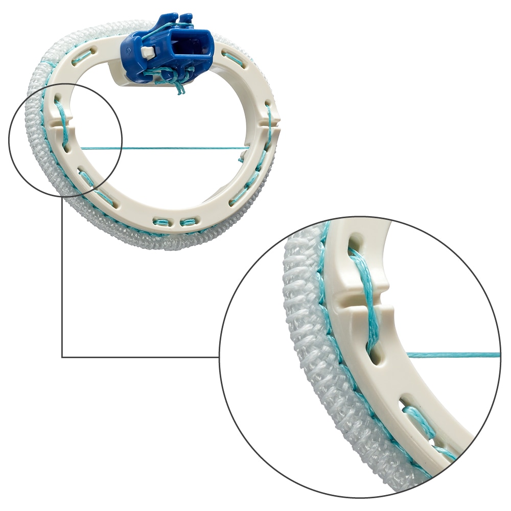 SimuForm™ Annuloplasty Ring | Medtronic (CA)