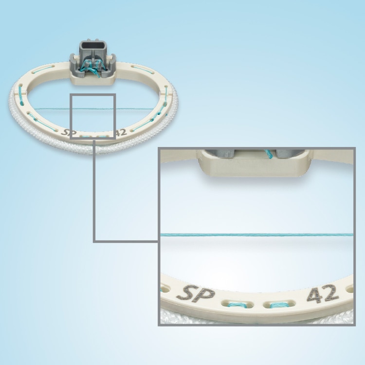 SimuPlus™ Flexible Annuloplasty Ring & Band | Medtronic (CA)