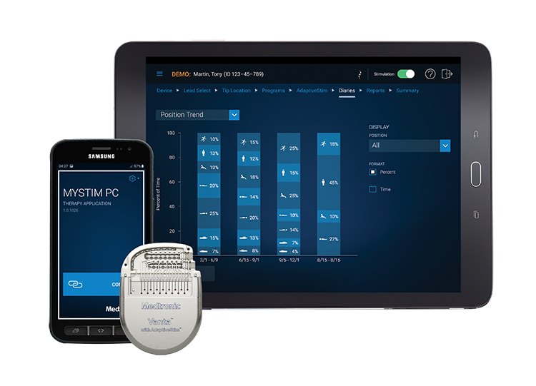 Vanta™ Neurostimulation System | Medtronic (CA)
