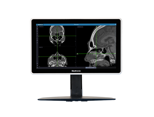 StealthStation FlexENT™ Navigation System | Medtronic (CA)