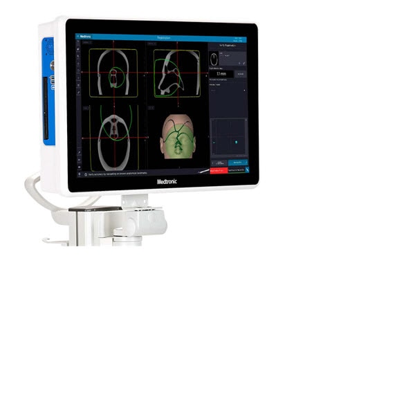 StealthStation FlexENT™ Navigation System | Medtronic (CA)