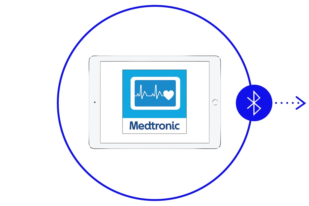 CareLink SmartSync™ Device Manager | Medtronic