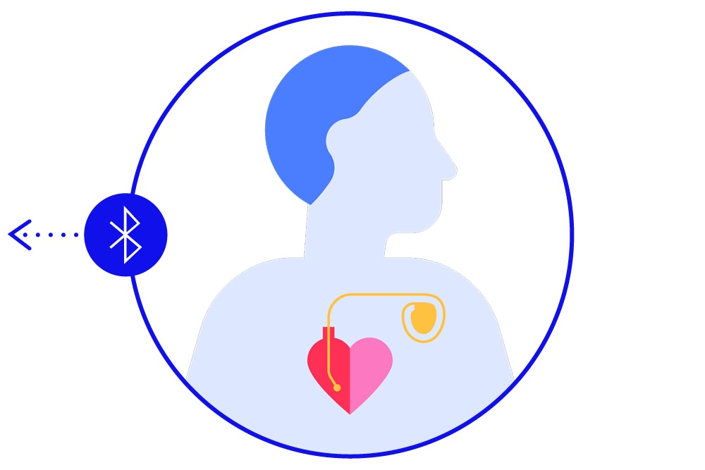 CareLink SmartSync™ Device Manager | Medtronic