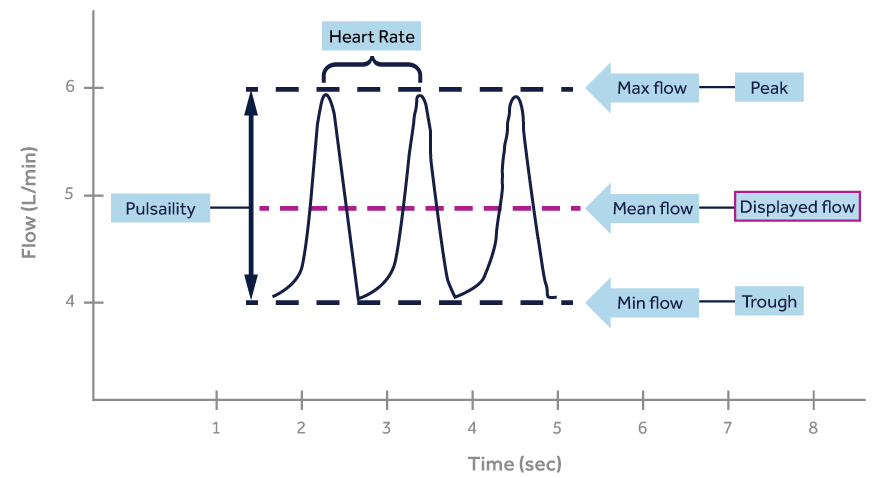 Autologs - HeartWare™ HVAD™ System | Medtronic