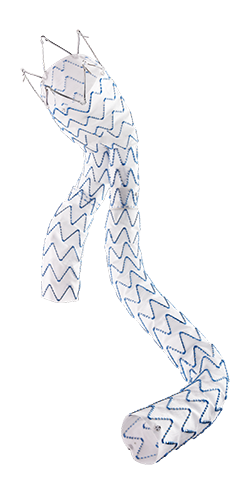 Endurant™ II/IIs Stent Graft System | Medtronic