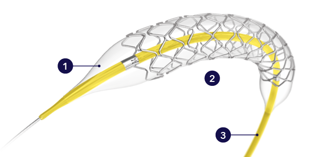 Onyx Frontier™ Drug-Eluting Stent (DES) | Medtronic
