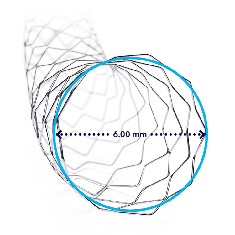 Onyx Frontier™ Drug-Eluting Stent (DES) | Medtronic