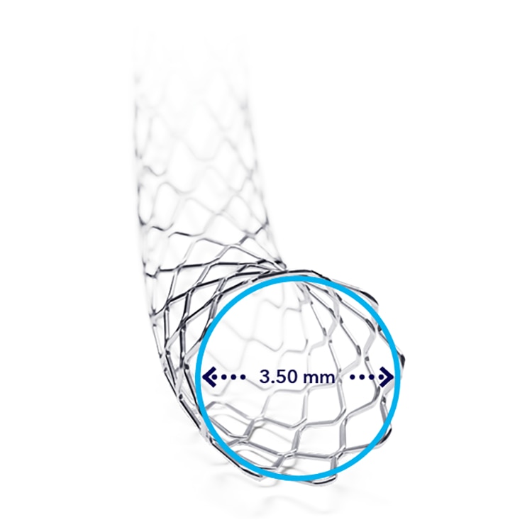 Onyx Frontier™ Drug-Eluting Stent (DES) | Medtronic