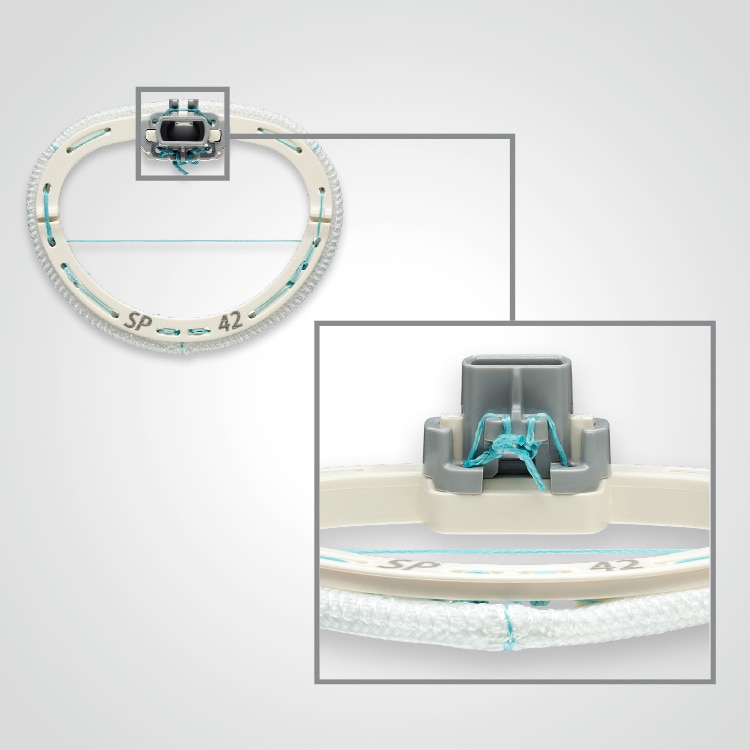 SimuPlus™ Flexible Annuloplasty Ring & Band | Medtronic