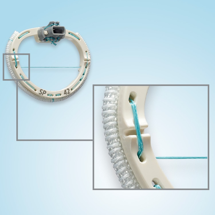 SimuPlus™ Flexible Annuloplasty Ring & Band | Medtronic
