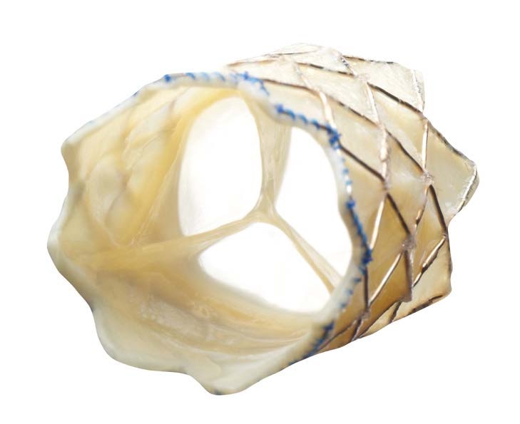 Melody™ Transcatheter Pulmonary Valve | Medtronic