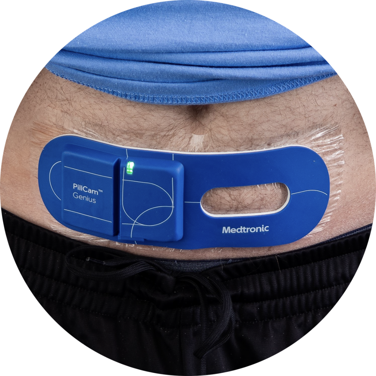 PillCam™ Genius SB Capsule Endoscopy Kit | Medtronic