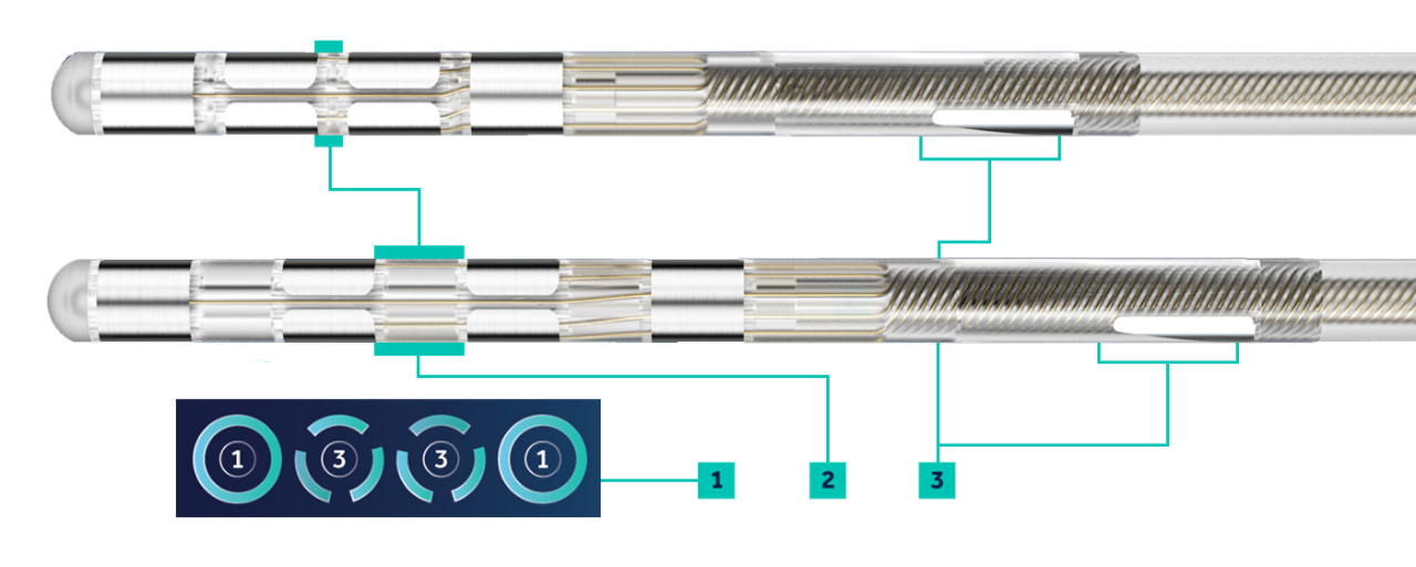 SenSight™ Directional Lead | Medtronic