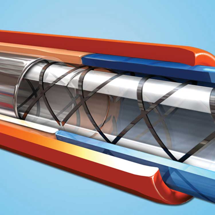 Onyx™ Liquid Embolic System | Medtronic