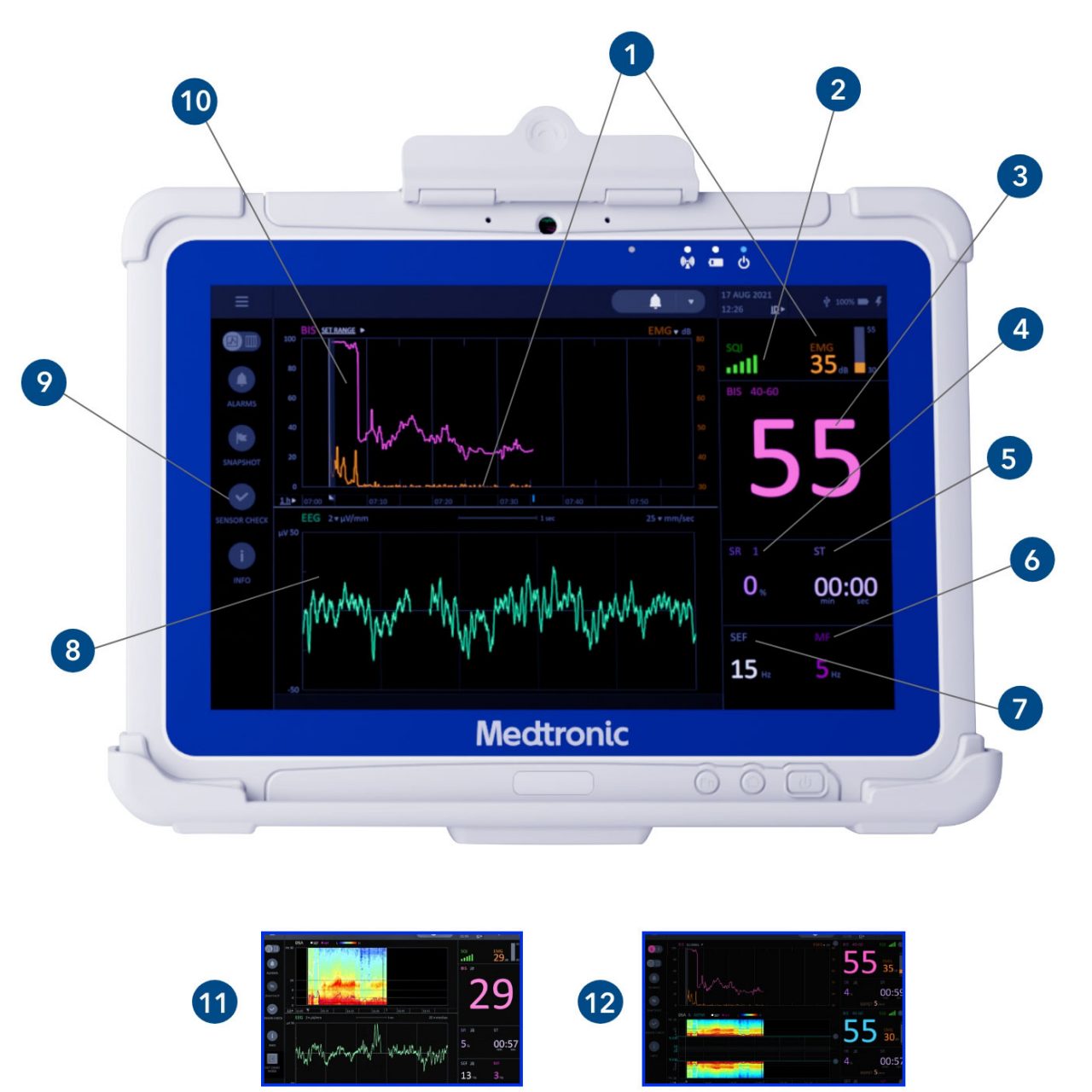 BIS™ Advance Monitor | Medtronic