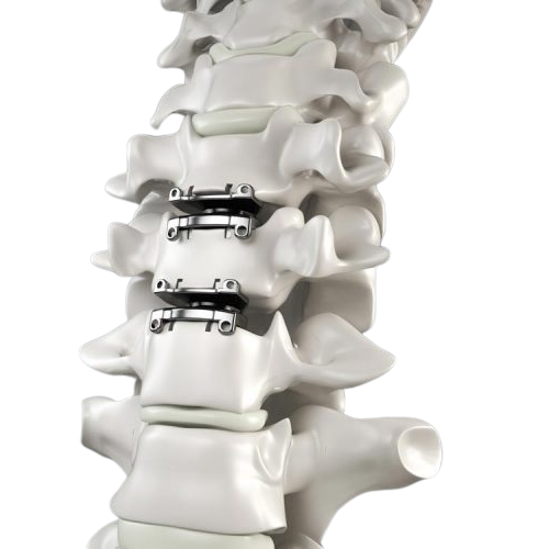 Prestige LP™ Cervical Disc | Medtronic