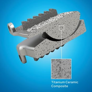 Prestige LP™ Cervical Disc | Medtronic