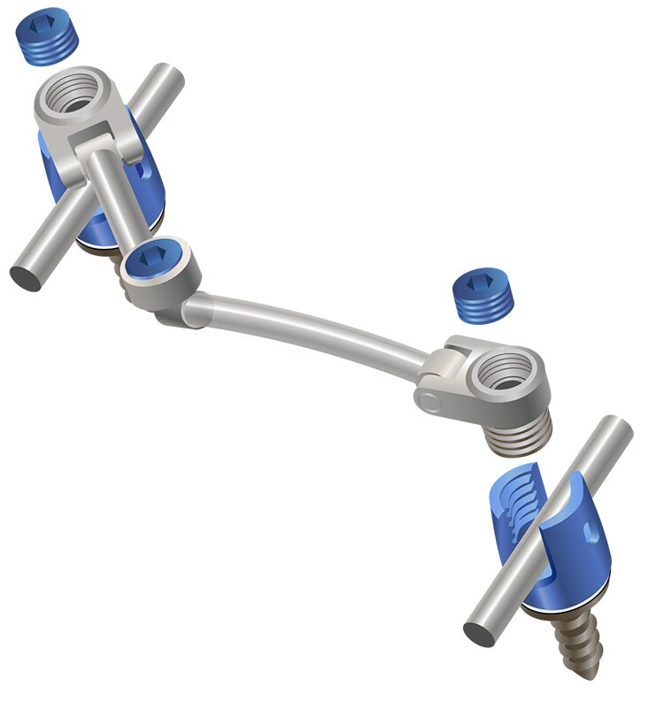 Infinity™ OCT System | Medtronic