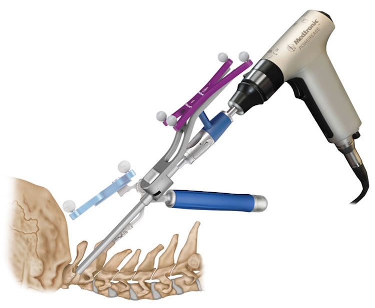 Infinity™ OCT System | Medtronic