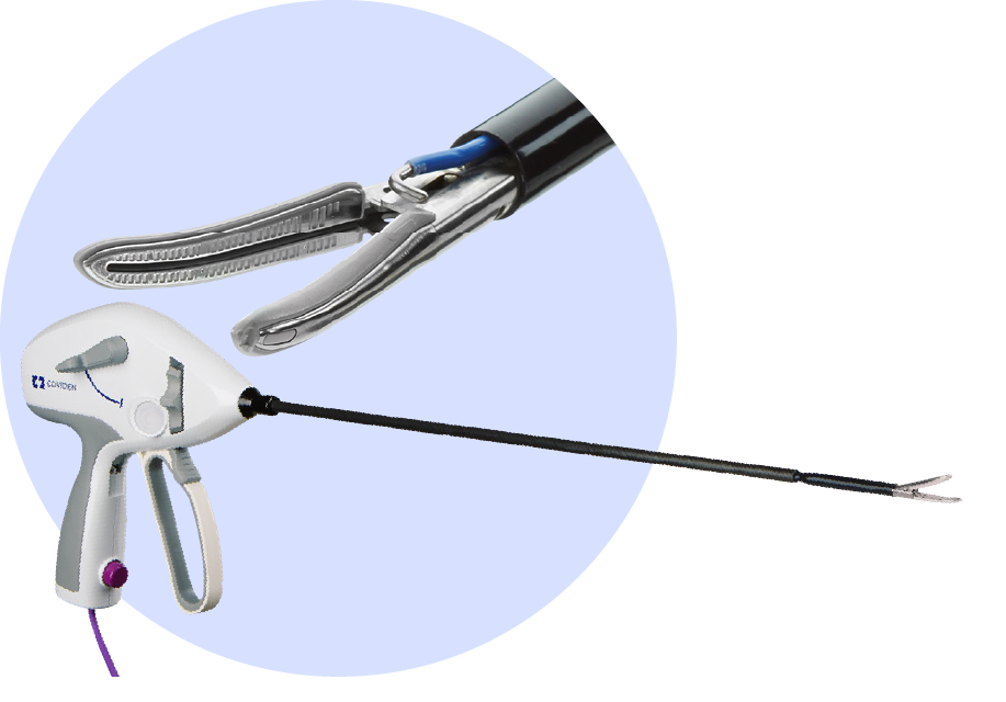 LigaSure™ Technology | Medtronic