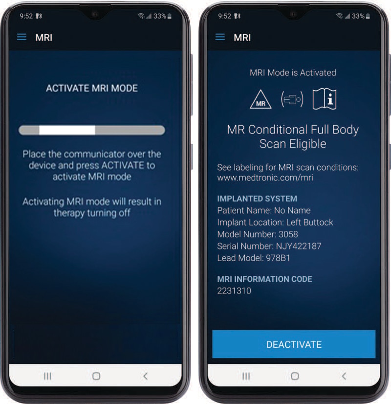MRI Information - Sacral Neuromodulation Therapies | Medtronic