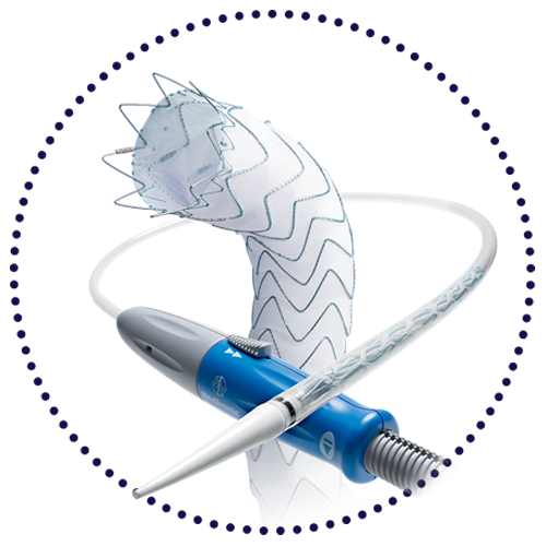 Thoracic Endovascular Aortic Repair (TEVAR) - Aortic Endovascular ...