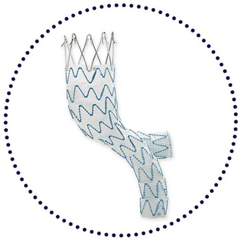 Clinical Evidence - Aortic Endovascular Repair | Medtronic