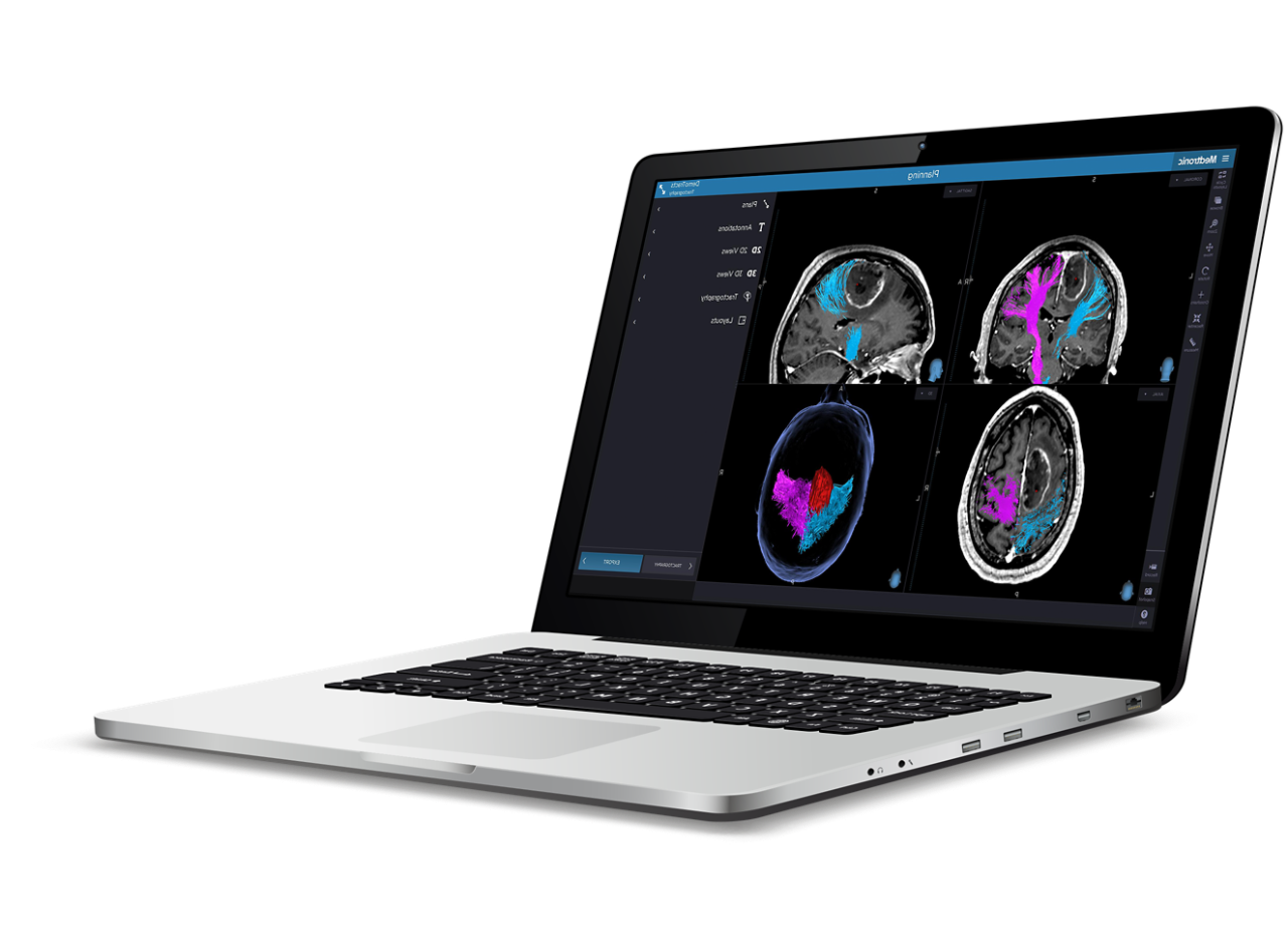 AiBLE™ Surgical Suite - Spinal Robotic-Assisted Surgery | Medtronic