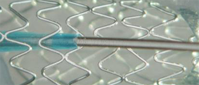 Sistema de Stent Liberador de Fármaco Resolute Onyx™ | Medtronic (CO)